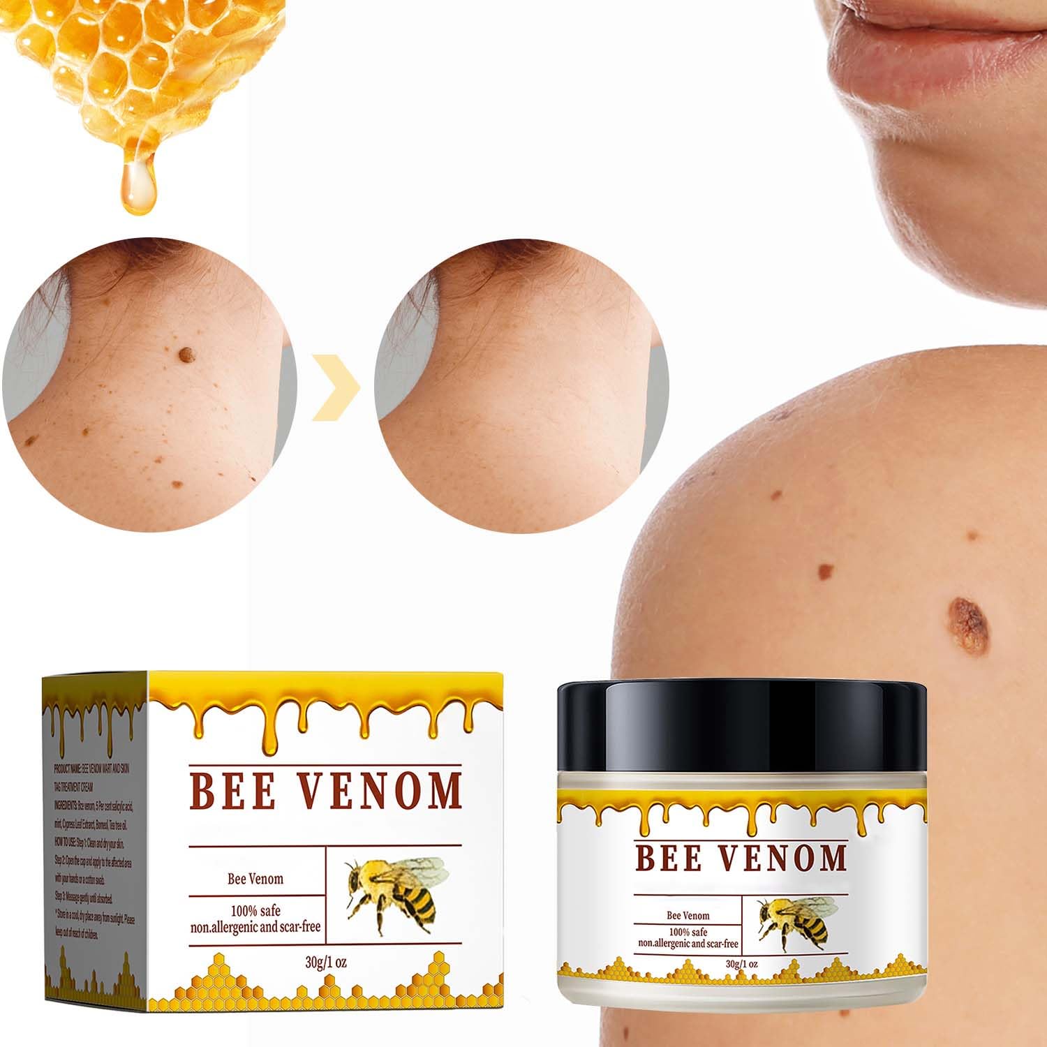 Bee Venom VS Botox: Review of Anti-Aging Treatments | Flawless Skin Journey